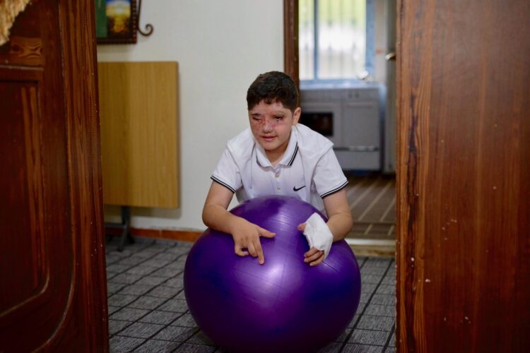 Israel’s pager attack: Survivors struggle to recover one year later ...